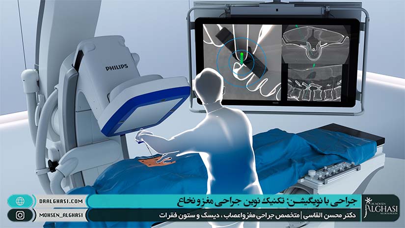 جراحی با سیستم نویگیشن؛ تکنیک نوین جراحی مغز و نخاع | دکتر القاسی